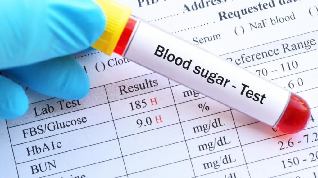 Apa itu Cek Gula Darah? Ini Jenis, Prosedur & Biaya