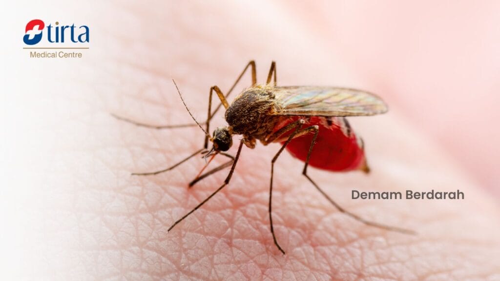 Apa itu Demam Berdarah? Ini Ciri-ciri & Pengobatannya