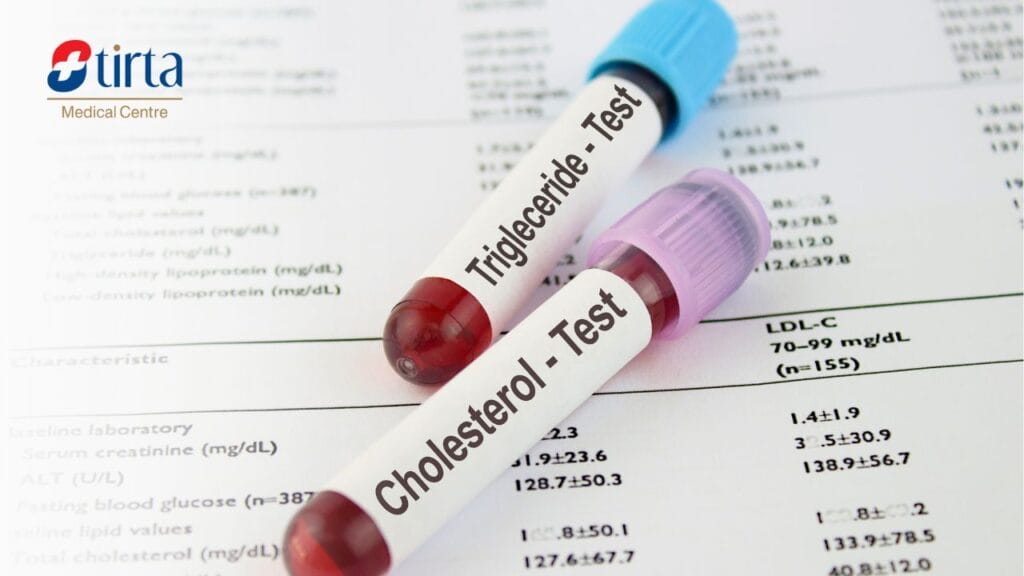 Cholesterol Test - Types, Benefits, Procedure, & Cost