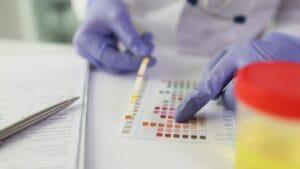 Tes Urine - Jenis, Manfaat, Prosedur, & Harga Tes