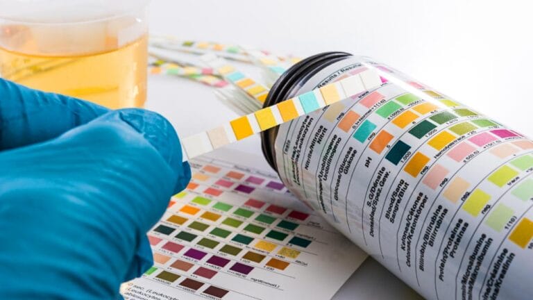 Tes Urine - Jenis, Manfaat, Prosedur, & Harga Tes