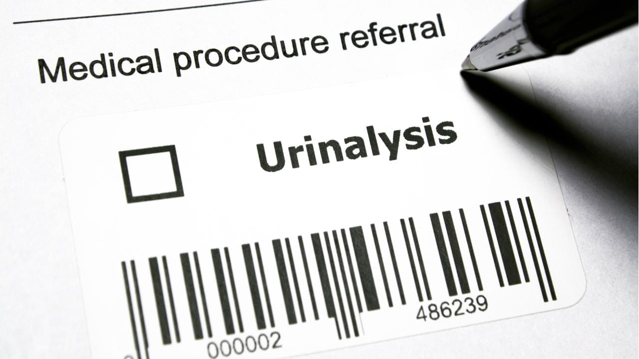 Tes Urine - Jenis, Manfaat, Prosedur, & Harga Tes