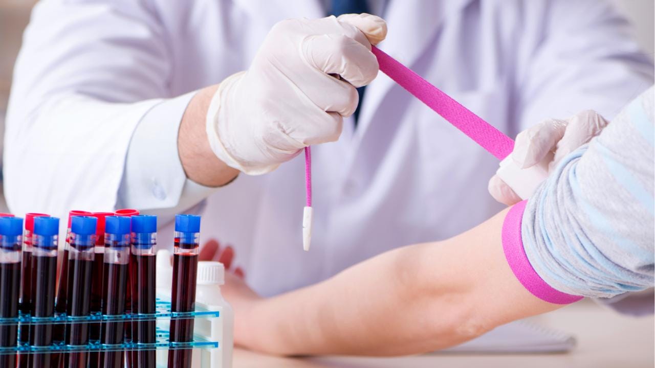 Pemeriksaan Hematologi Rutin - Manfaat, Prosedur, & Biaya