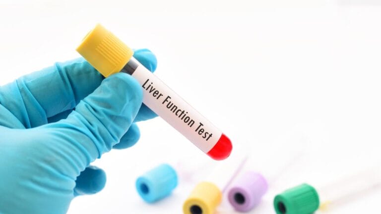 Pemeriksaan SGOT - Cek Fungsi Hati & Nilai Normalnya