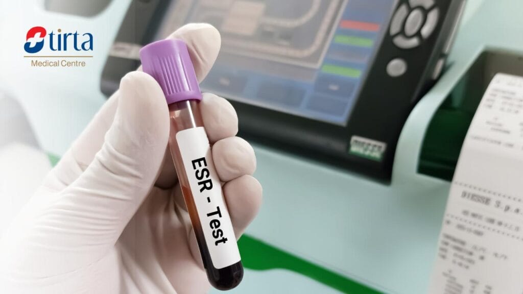 High Erythrocyte Sedimentation Rate (ESR) - Causes, Types, & Results