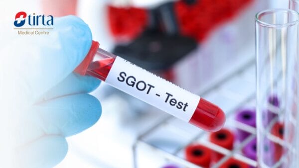 SGOT Test - Liver Function Check & Normal Values