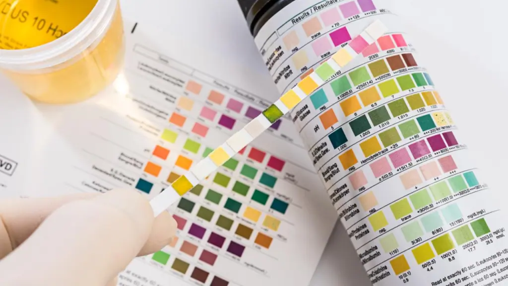 10 Warna Urine & Artinya yang Perlu Anda Ketahui