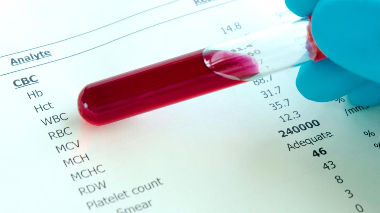 Hematologi Lengkap: Diagnosis Penyakit hingga Biaya Tes
