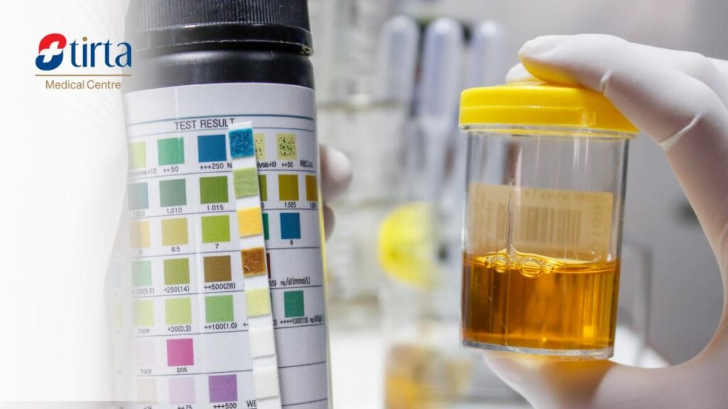 7 Types of Kidney Function Tests and Normal Results - TMC