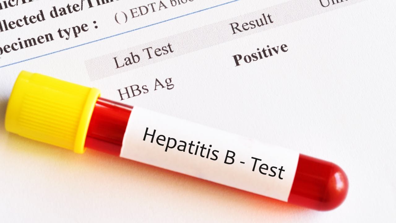 Tes HBsAg: Manfaat untuk Diagnosis Hepatitis B - TMC