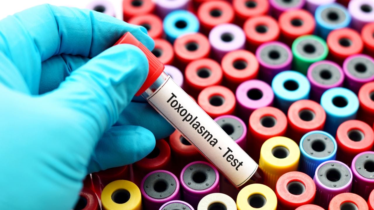 Pemeriksaan TORCH: Tujuan, Jenis, Prosedur, & Hasil Tes