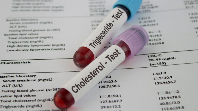 Kolesterol Normal Wanita & Pria, Sesuai Usia & Jenis