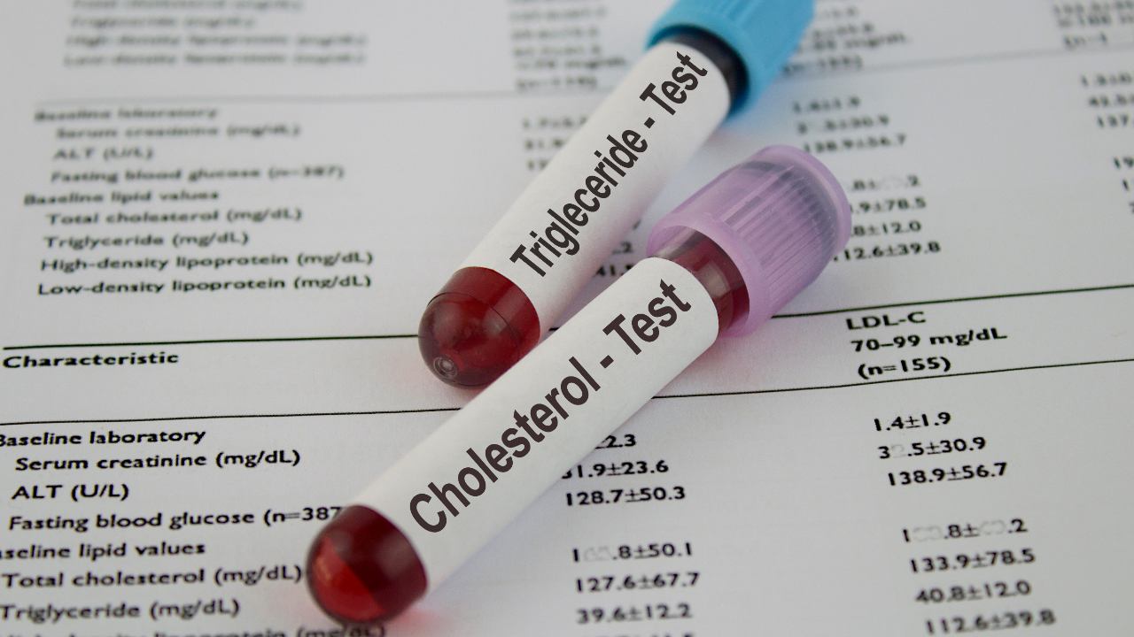 Kolesterol Normal Wanita & Pria, Sesuai Usia & Jenis