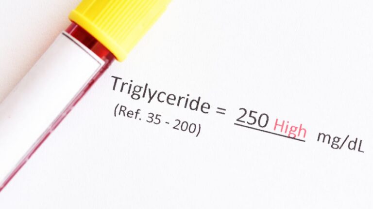 Cek Trigliserida: Prosedur, Biaya, & Kadar Normalnya