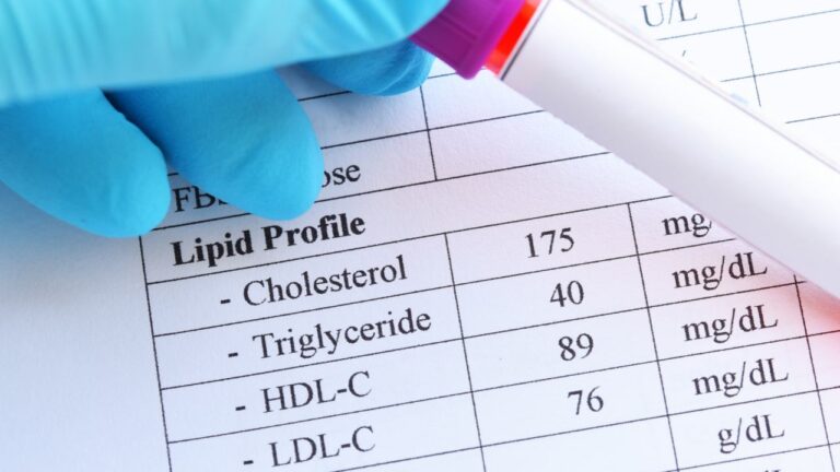 Cek Trigliserida: Prosedur, Biaya, & Kadar Normalnya