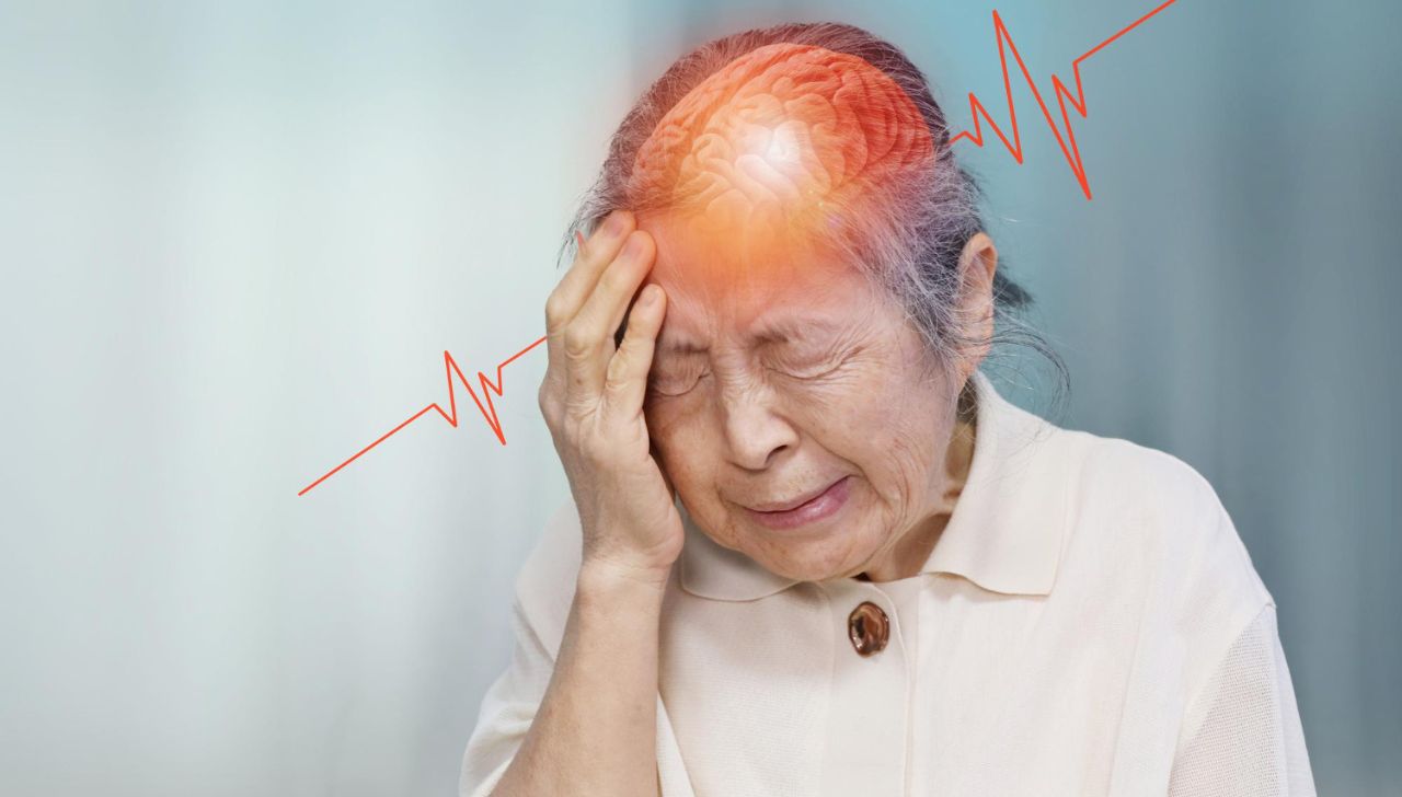 Stroke - Gejala, Penyebab, Pengobatan, & Cara Mencegah