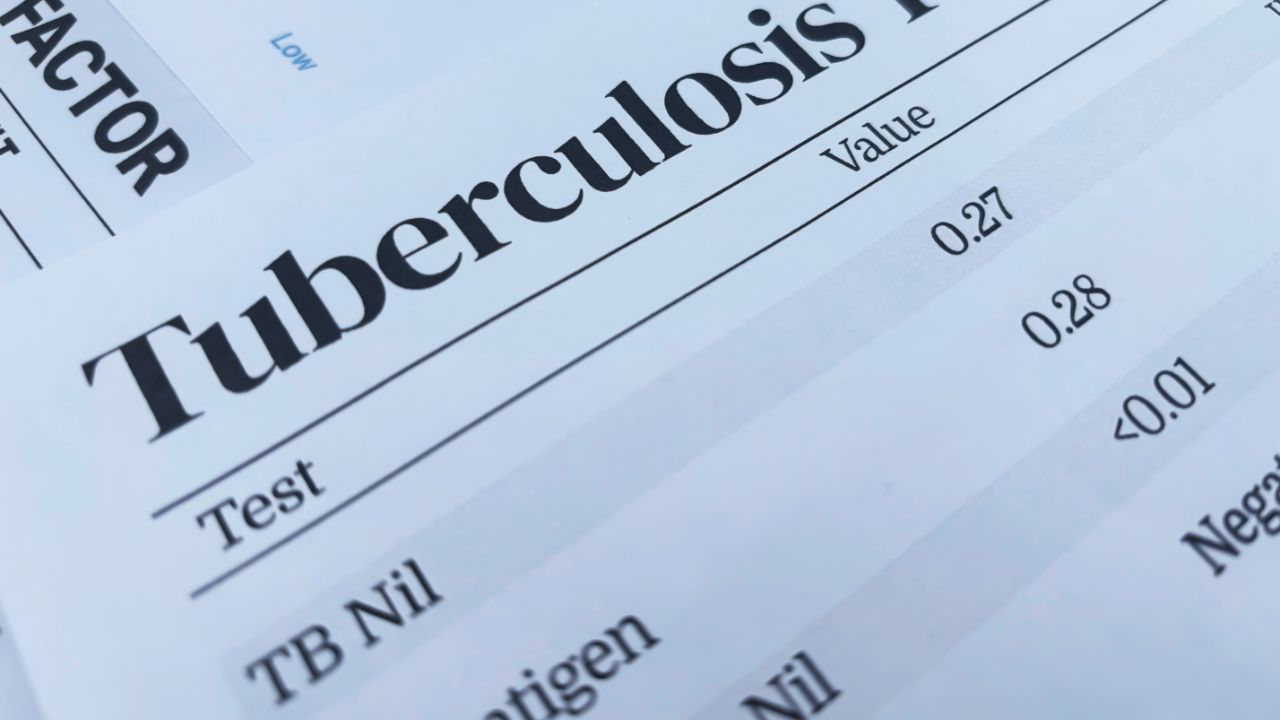 Cara Penularan TBC (Tuberkulosis) - Tirta Medical